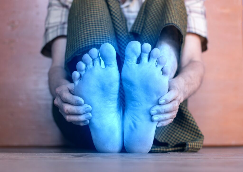 Poor Circulation: Symptoms, Causes, Treatment - Laurel Clinical