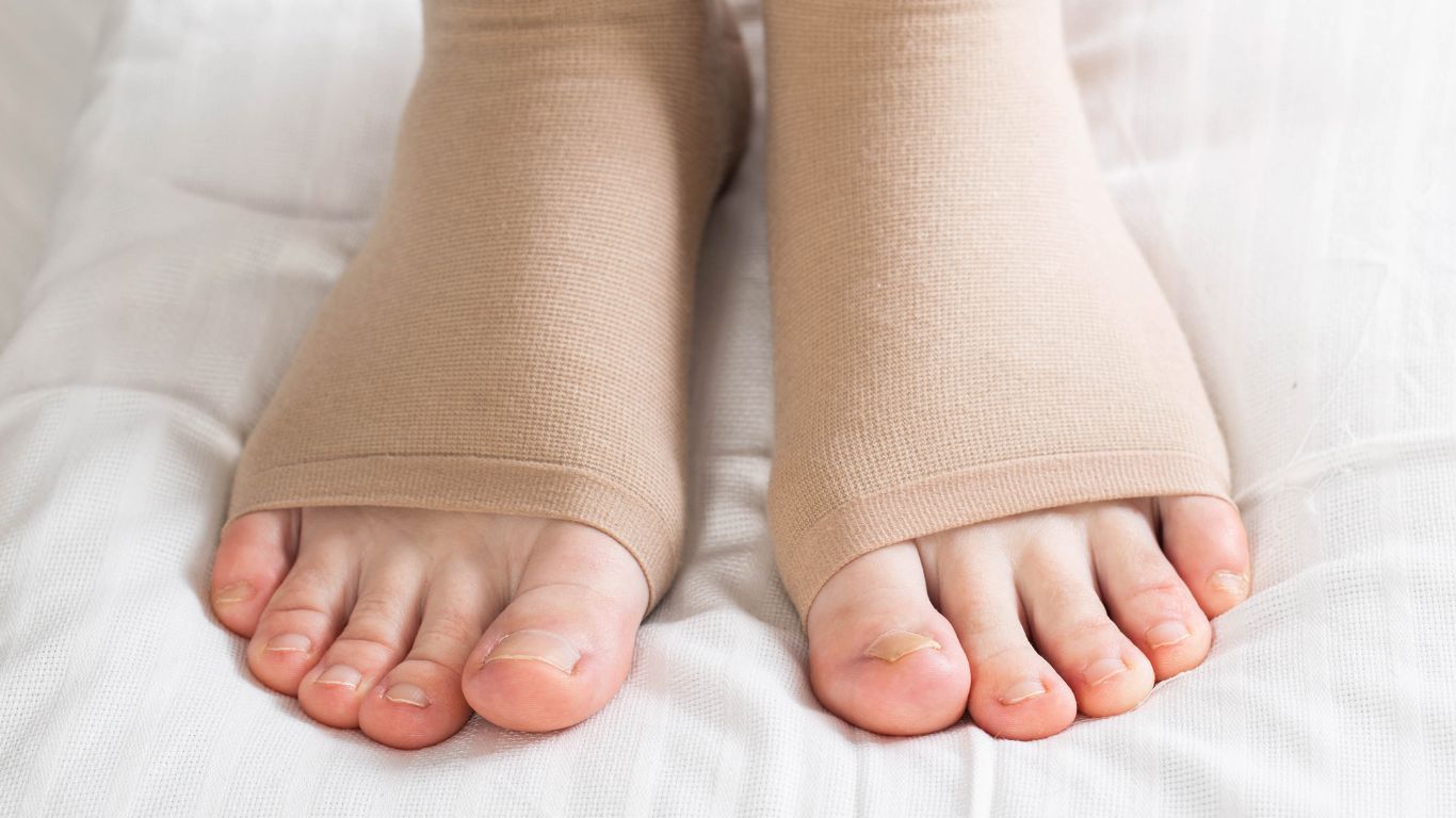 Lymphoedema - Laurel Clinical